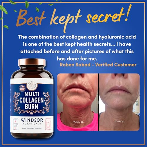 collagen supplement for youthful skin