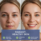 Collagen support for vibrant skin