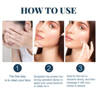collagen threads for facial contouring