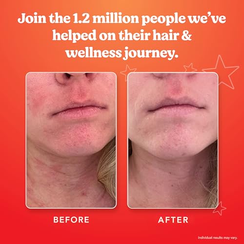 collagen type 2 for flexibility