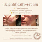 collagen type 2 for flexibility