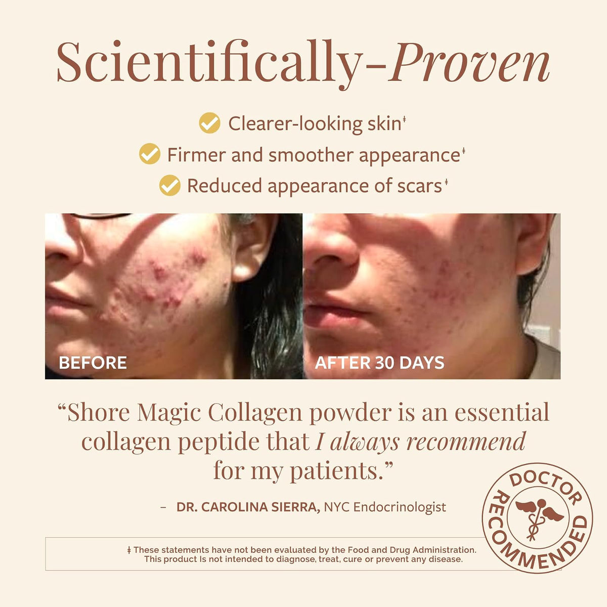 collagen type 2 for flexibility