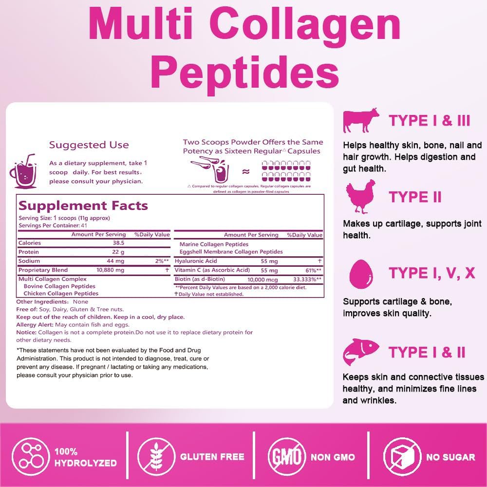 collagen type 2 for improved mobility