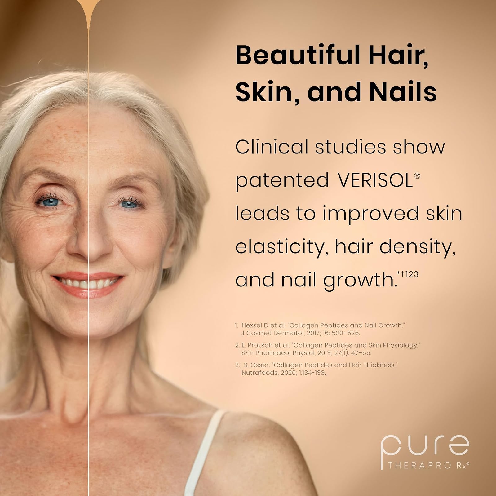 Collagen type 2 for improved mobility