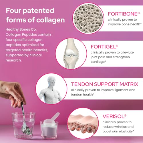 collagen type 2 for improved mobility