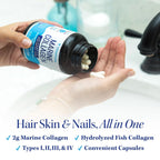 collagen type 2 for joint health