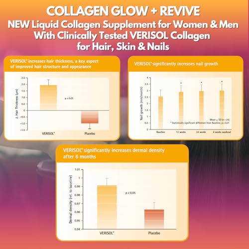 collagen type 2 for joint support