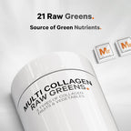 Collagen type 2 for joint support