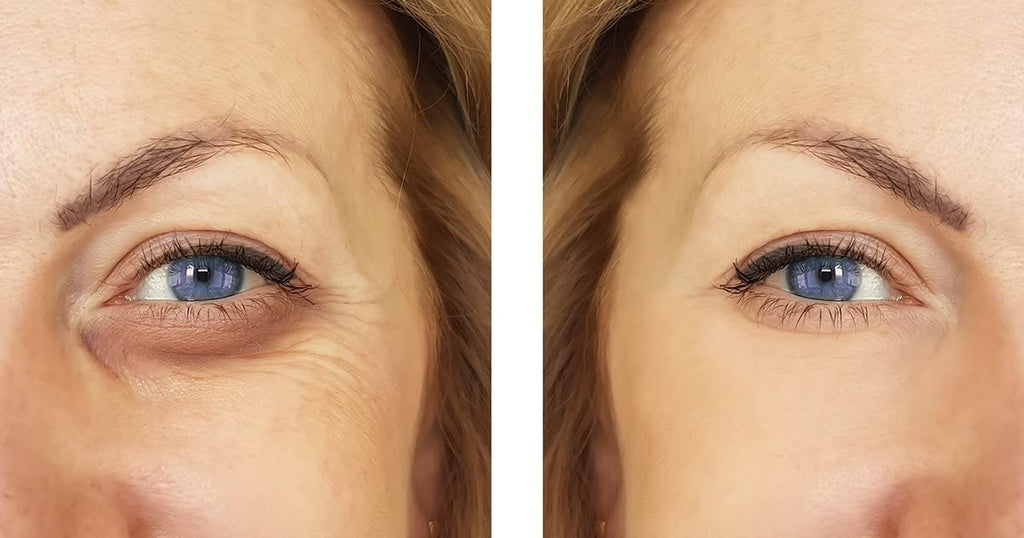 Collagen type 2 for joint support