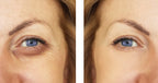 Collagen type 2 for joint support