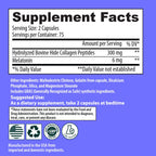 collagen type 2 for joint support