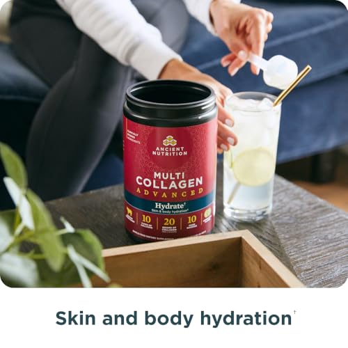 Collagen type 2 for joint support