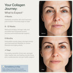CollaVita collagen for healthy nails