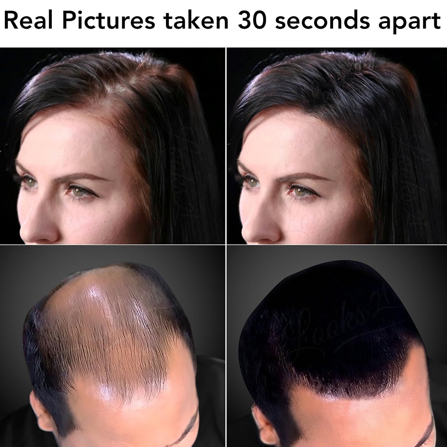 conceal thinning hair effectively