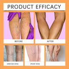 Curcumin infused vein relief patches