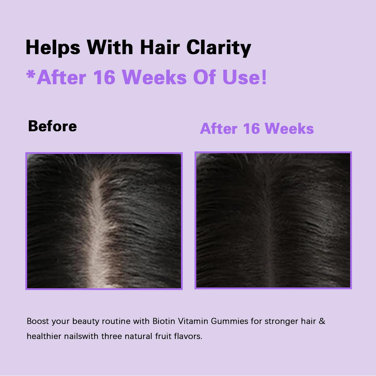 Delicious biotin gummies for hair