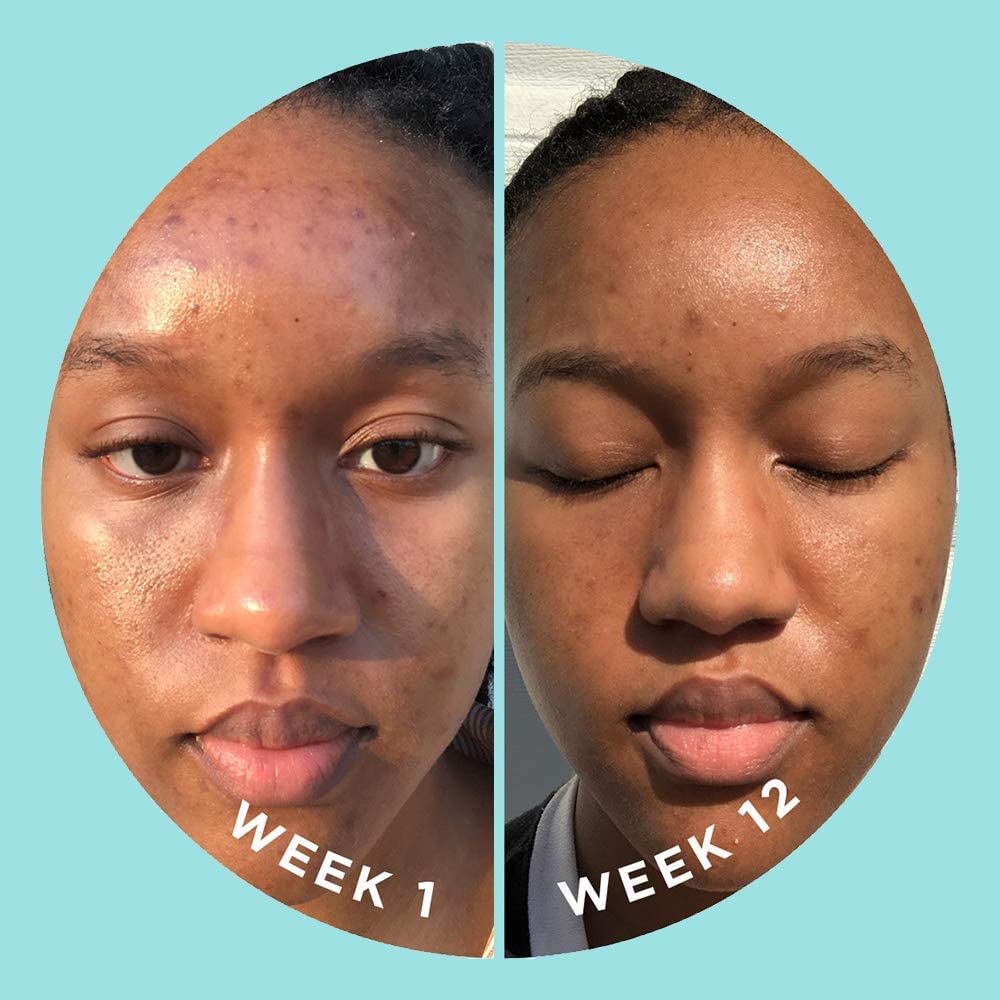 dermatologist recommended vitamin capsules