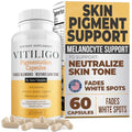 Dermawonder Vitiligo Capsules benefits