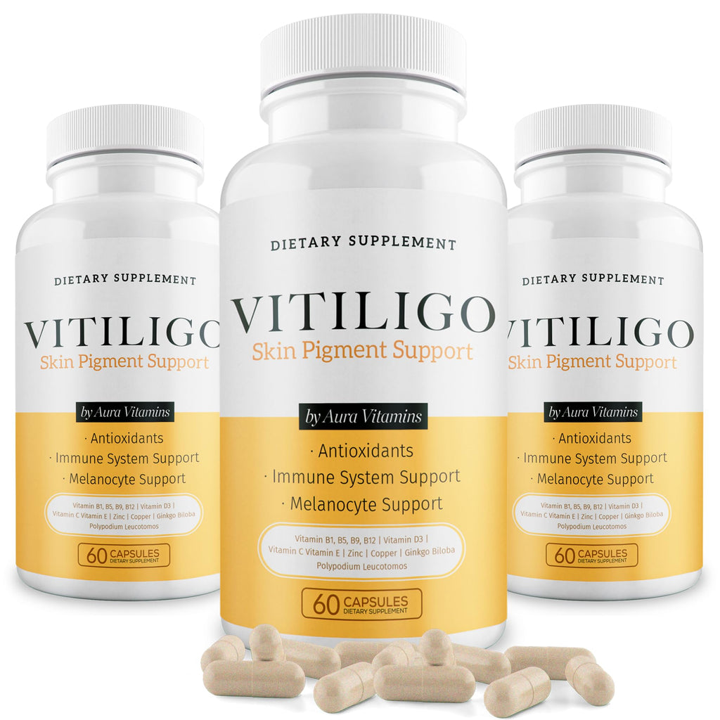 Dermawonder vitiligo capsules for skin health