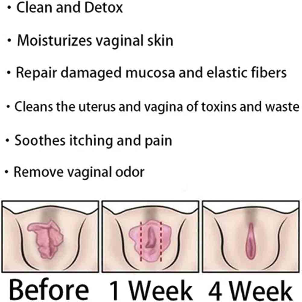 detox vaginal capsules for holistic wellness