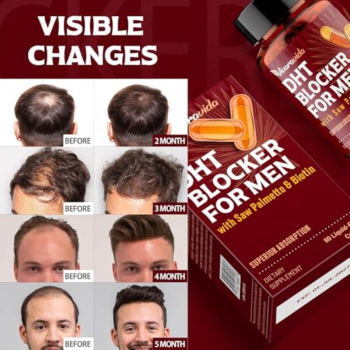 DHT blocker with biotin support