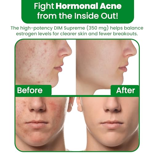 DIM capsules for hormonal support