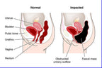easy detox solution for busy lifestyles