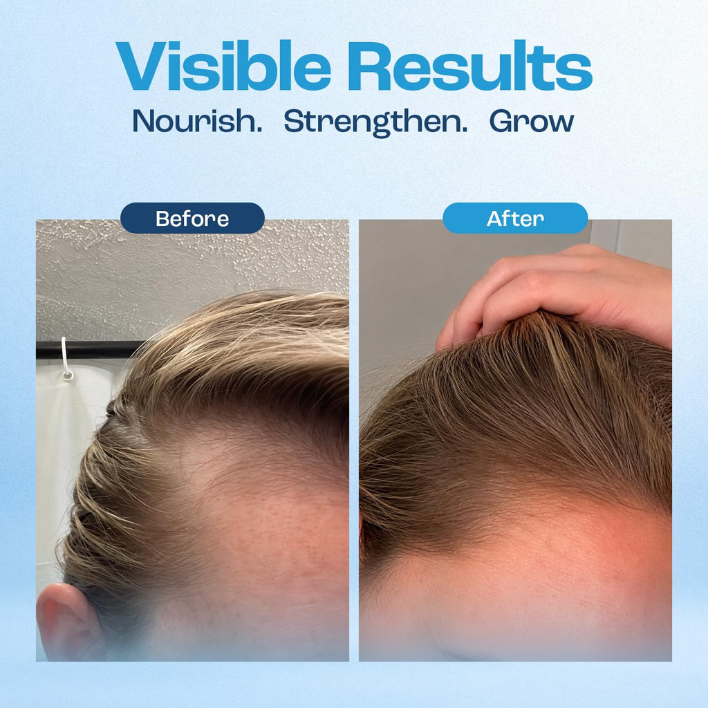 easy-to-take hair health gummies
