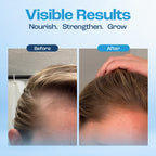 easy-to-take hair health gummies