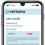 easy vitamin b9 and b12 analysis