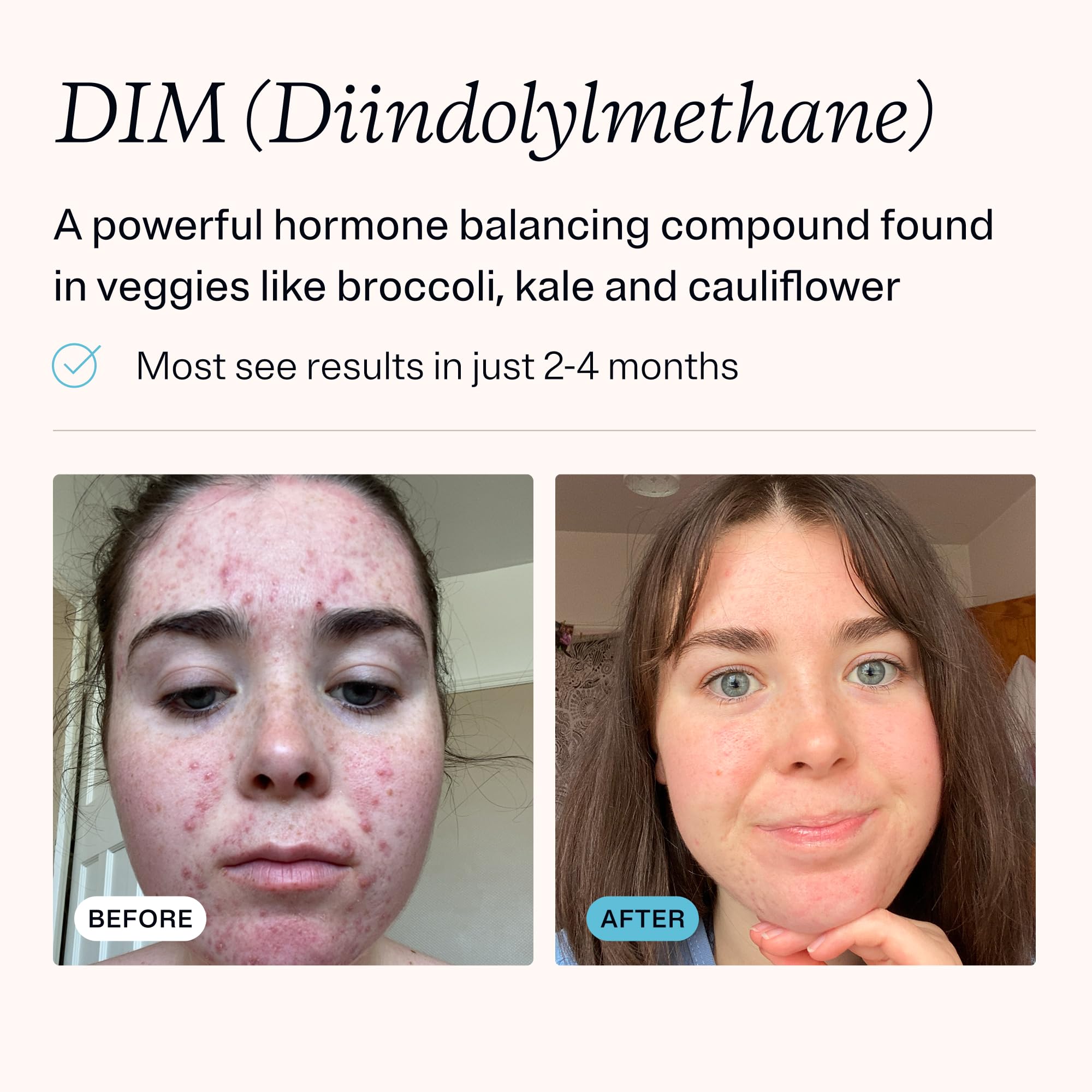 effective acne treatment with blended supplements