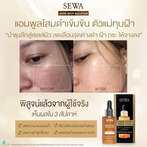 Effective Malasma Treatment with Ginseng