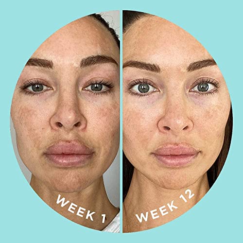 effective vitamin supplements for acne
