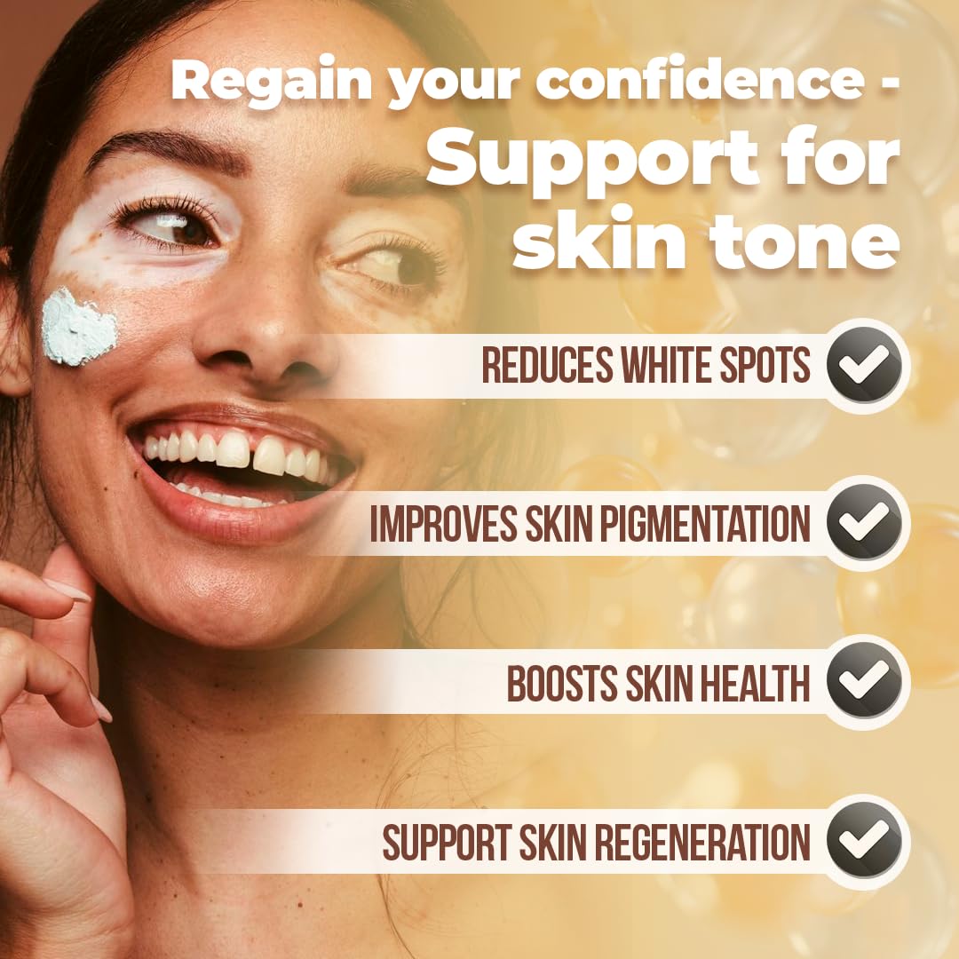 effective vitiligo treatment capsules