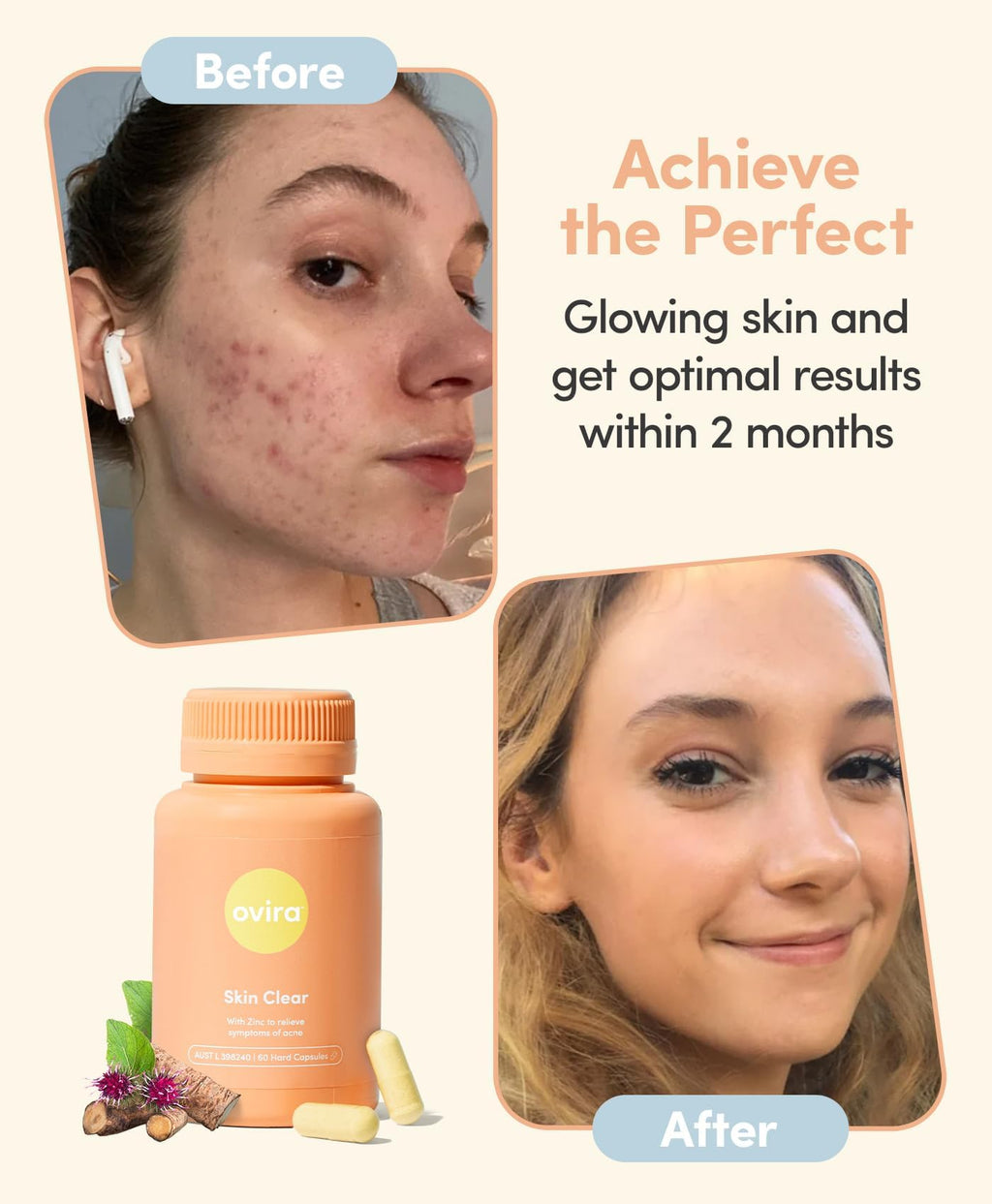 enhance skin clarity with Ovira