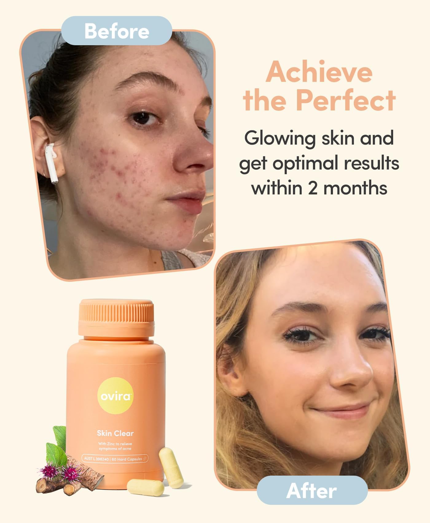 enhance skin clarity with Ovira