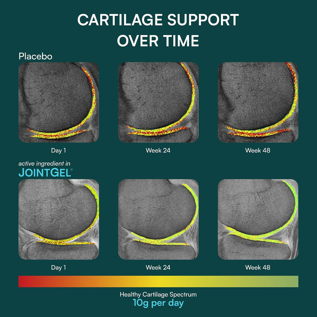 enhanced joint flexibility with MSM