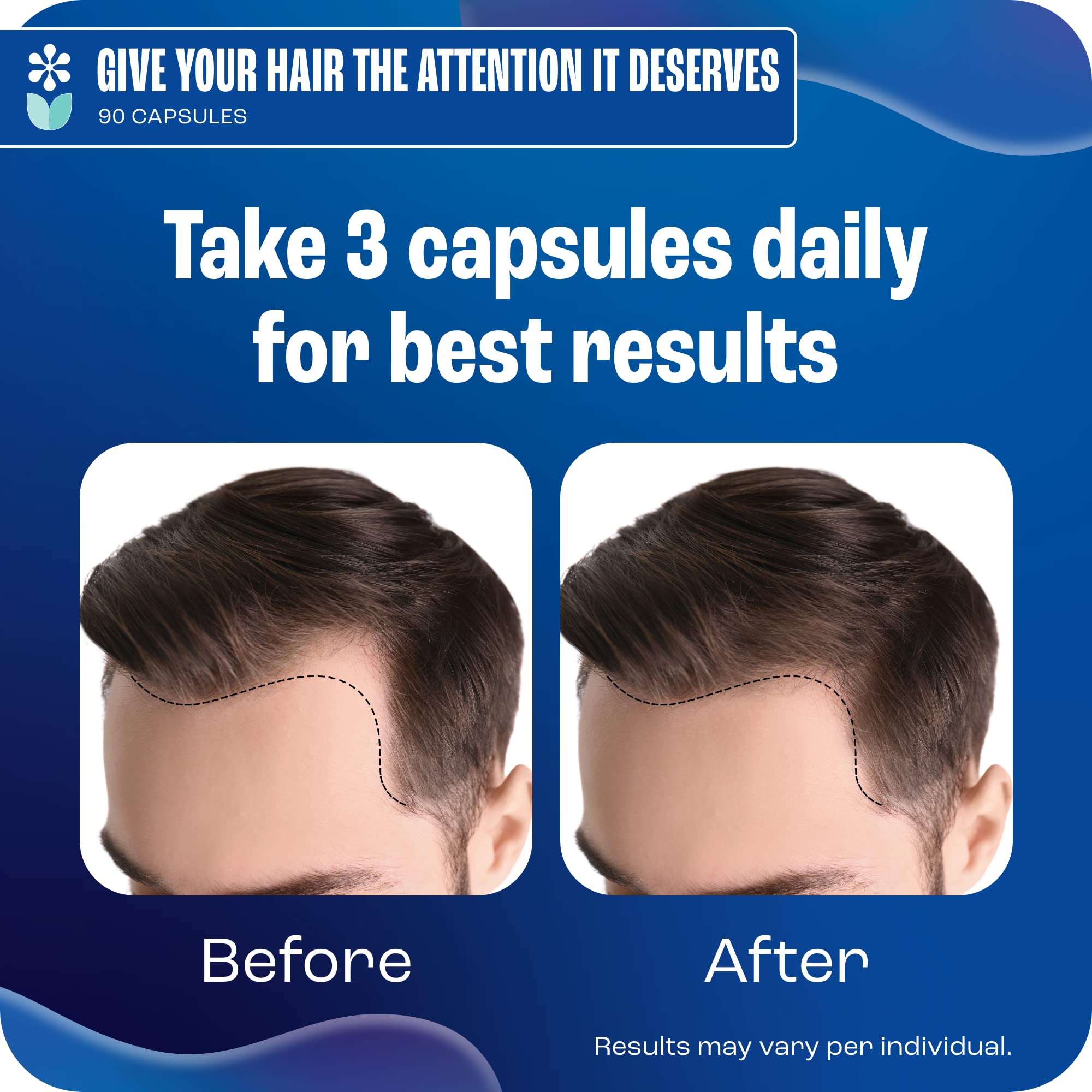 essential vitamins for men's hair