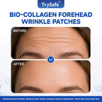 forehead patches for youthful appearance