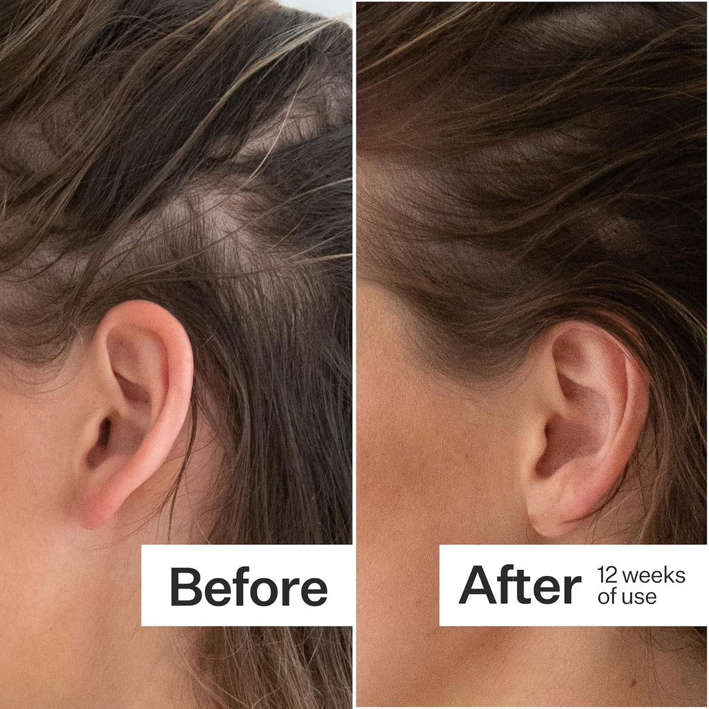 fuller hair biotin vitamins