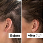 fuller hair biotin vitamins