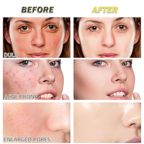 gentle exfoliation with WEEMAY turmeric pads