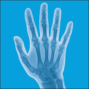 glucosamine chondroitin for mobility