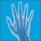 glucosamine chondroitin for mobility