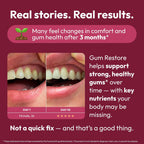 gummy multivitamin for easy consumption