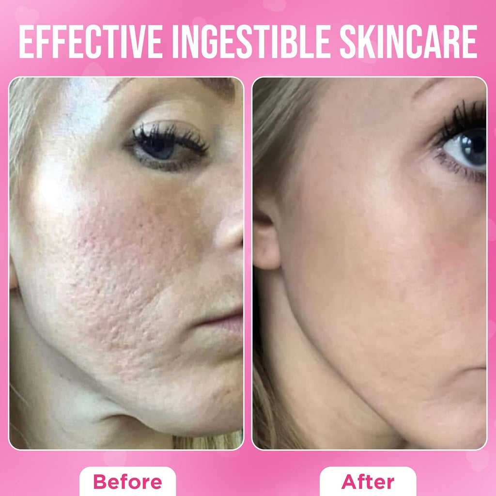 gummy multivitamin for healthy skin