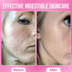 gummy multivitamin for healthy skin