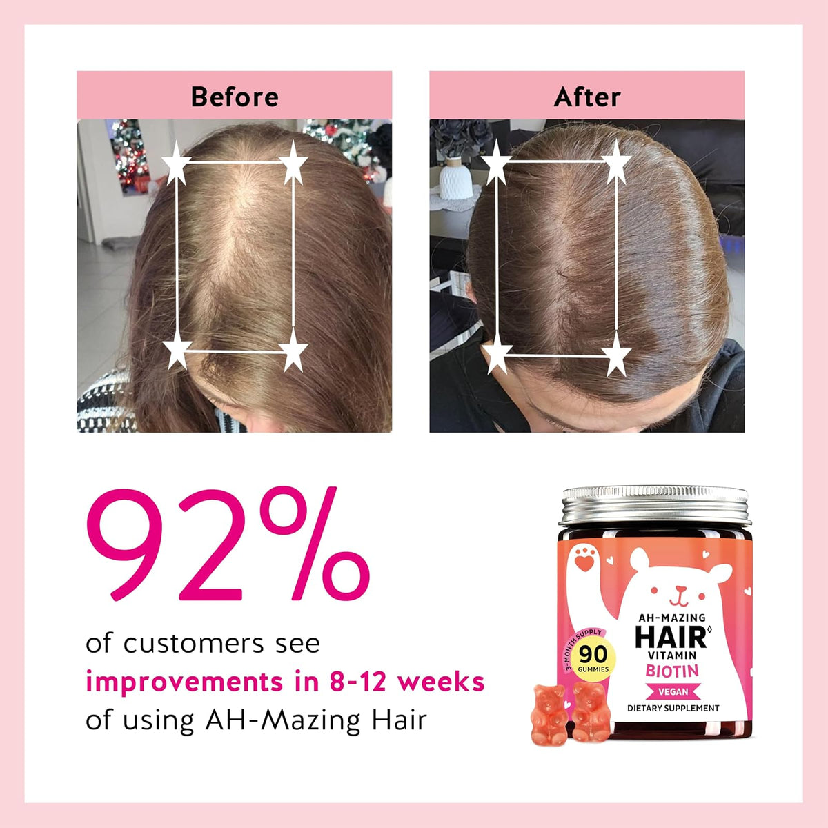 hair growth support biotin gummies