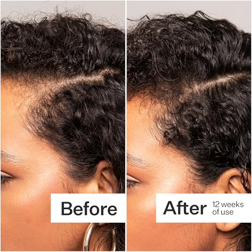 hair health support with biotin