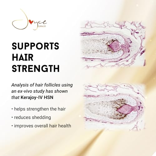 hair loss prevention supplements Canada